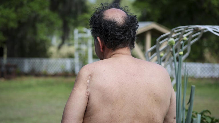 Pasco police chase left him disabled. 5 years later, his family still ...