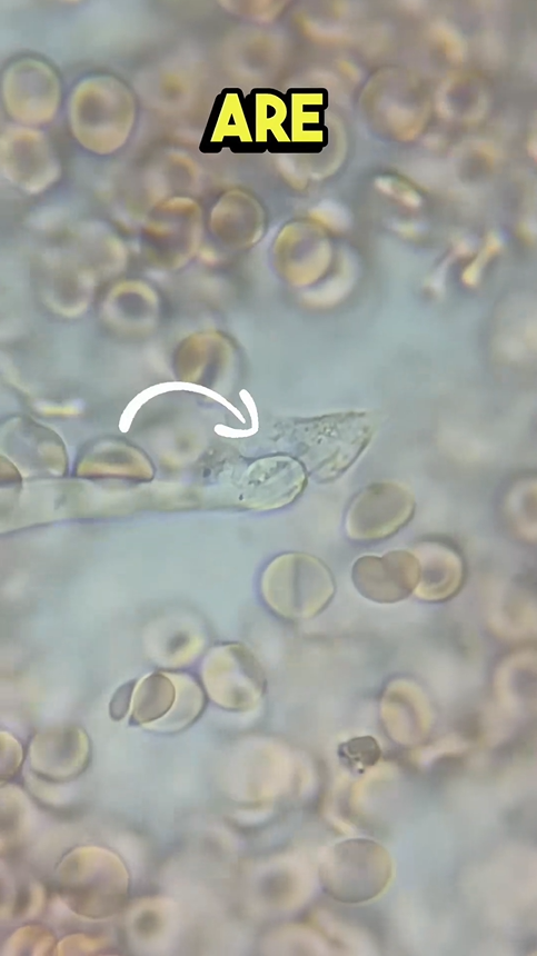 Parasite battle against white blood cells under the microscope