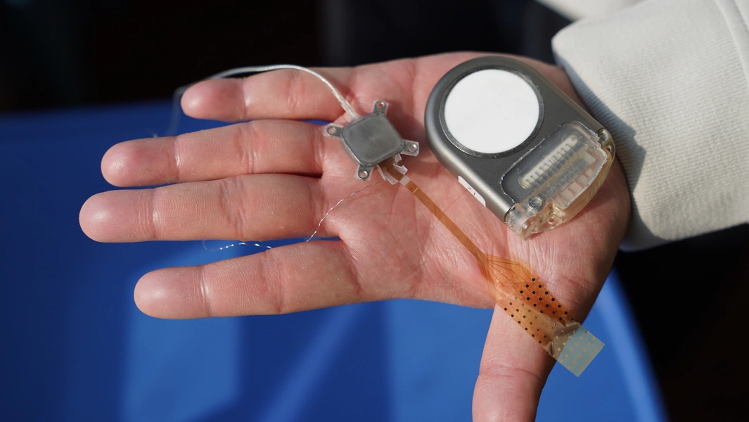 China approves first commercial brain implant for paralysis