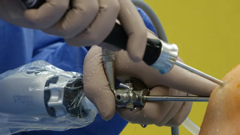 Capsule endoscopy market to reach $2.15B by 2033 on GI disease surge