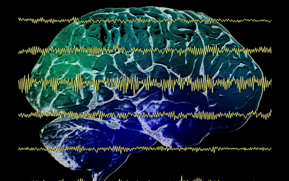 Speed training could keep your brain younger