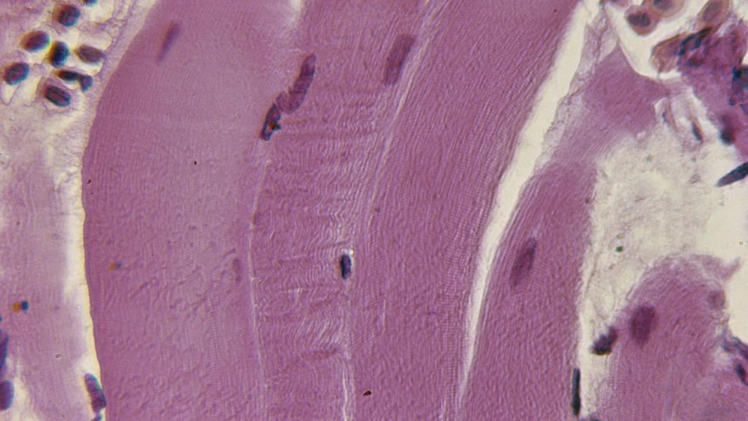 UMaine study identifies MYLPF as key to muscle function