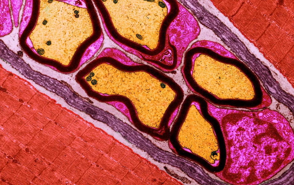 UMaine study identifies MYLPF as key to muscle function
