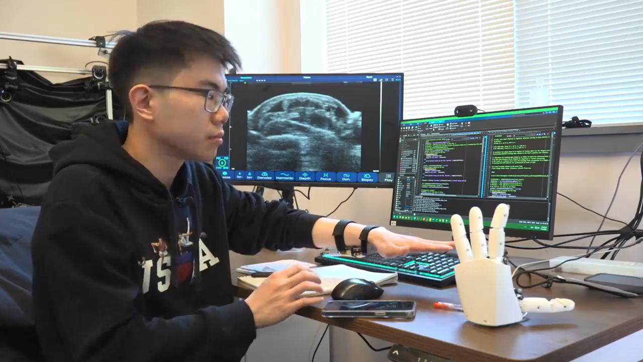Engineers build AI-powered ultrasound wristband that enables realtime ...
