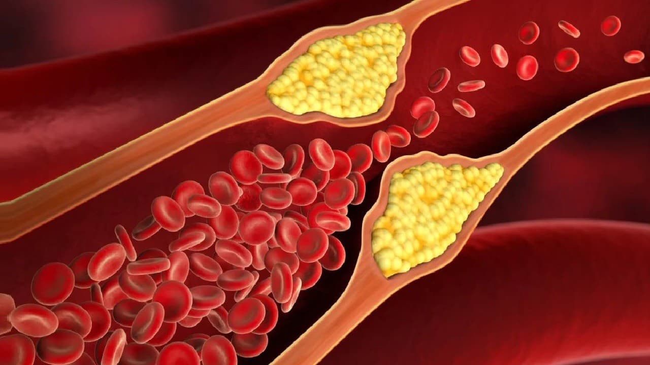 Cholesterol control: 7 simple lifestyle tweaks to keep your heart happy!