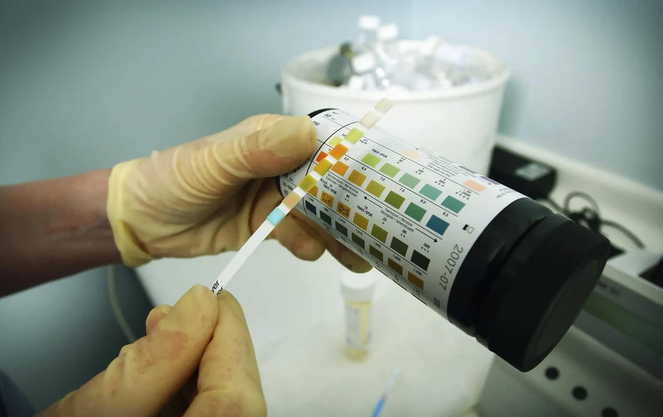 What your pee says about your health