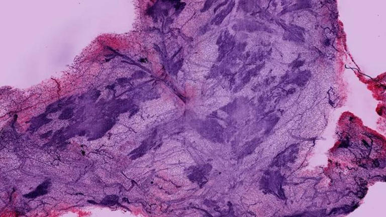 New HySIL lens design makes high-resolution 3D brain and cancer imaging ...