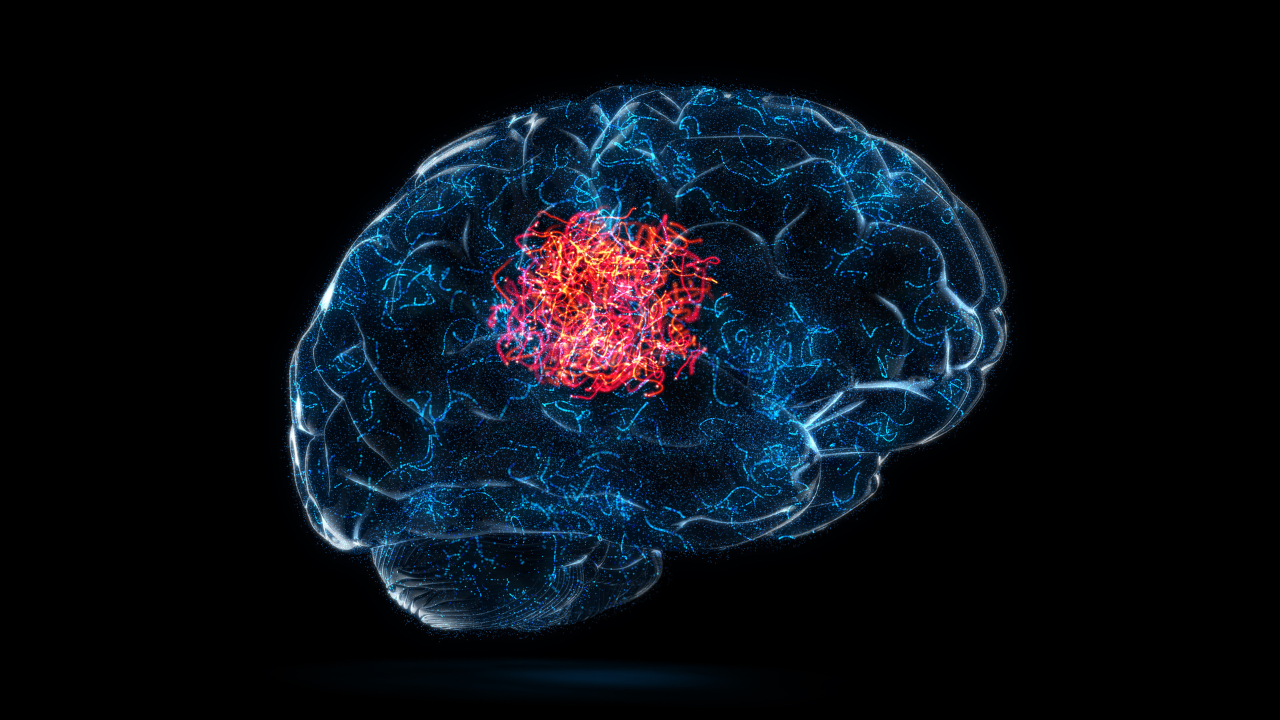 5 brain tumour myths that experts wish people would stop believing