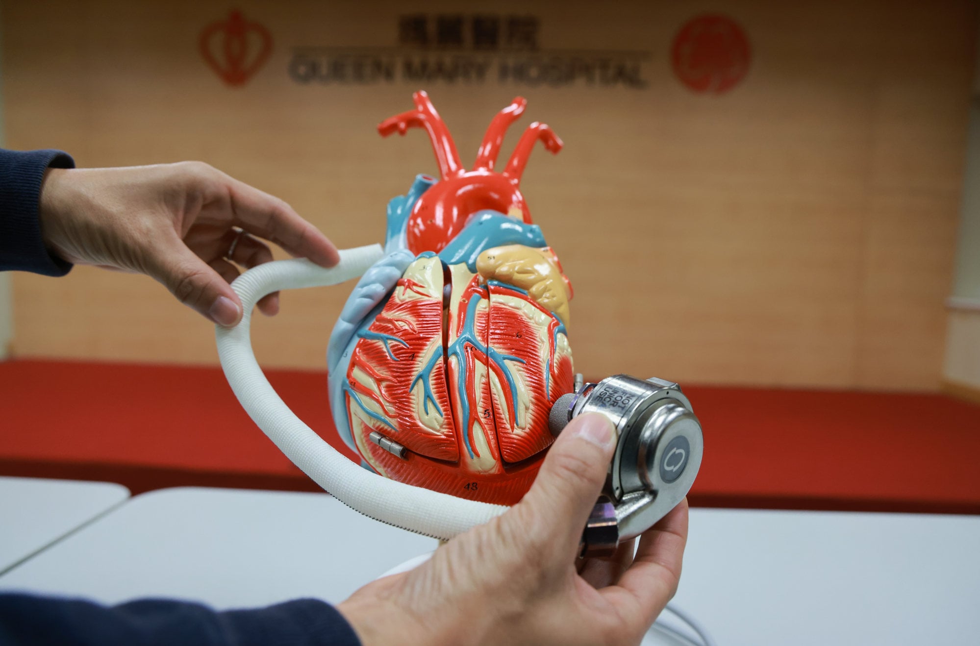 Hong Kong appeals for heart-lung donor to save critically ill 13-year ...