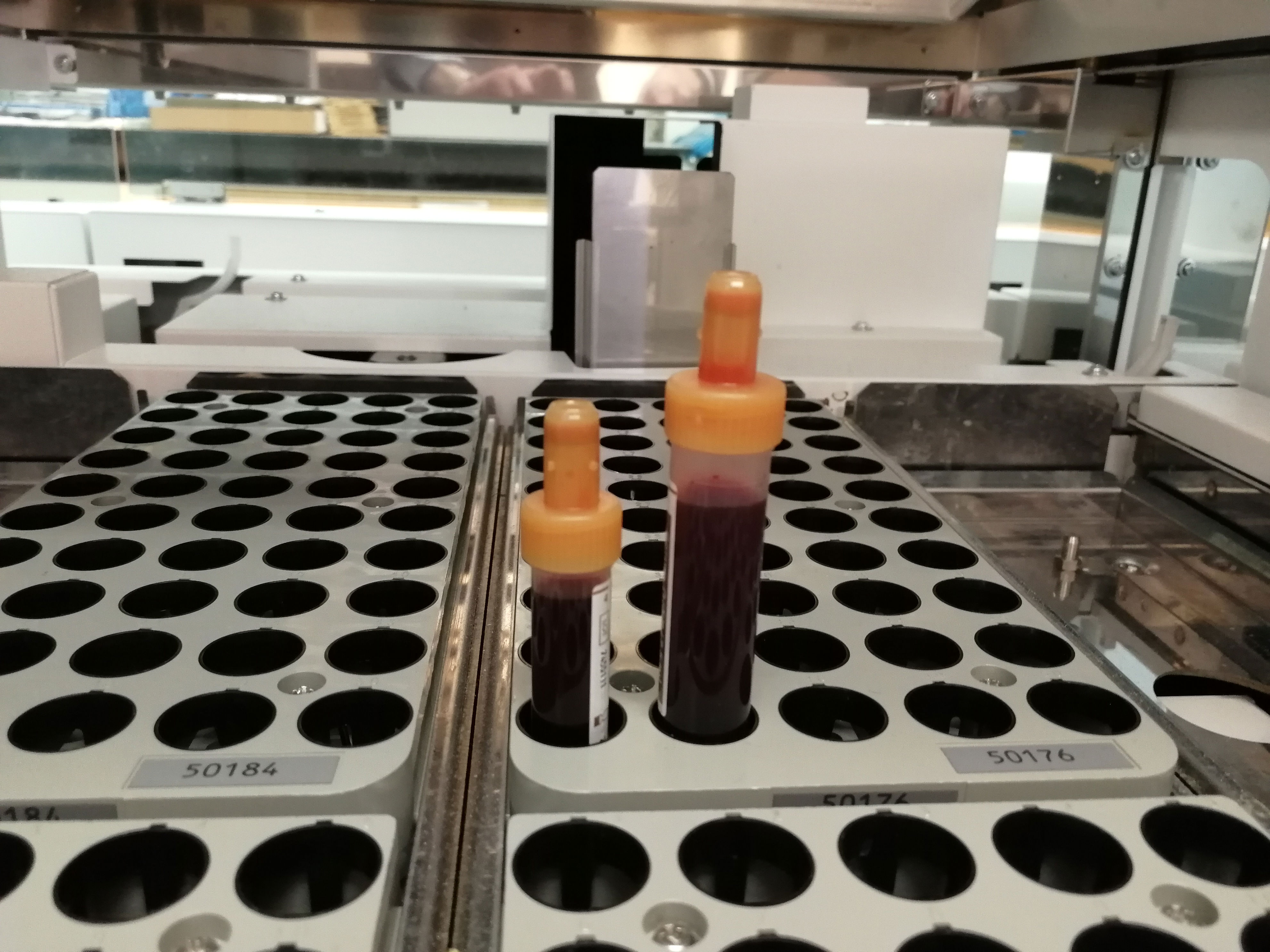 East Lancashire blood tests set for disruption as Burnley and Blackburn ...