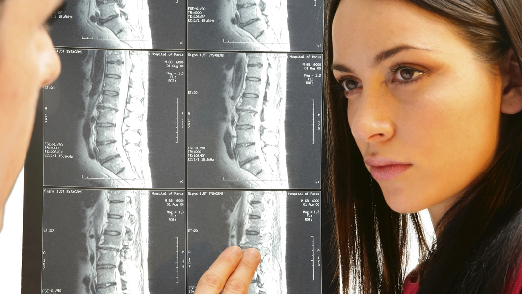 Living well with ankylosing spondylitis every day