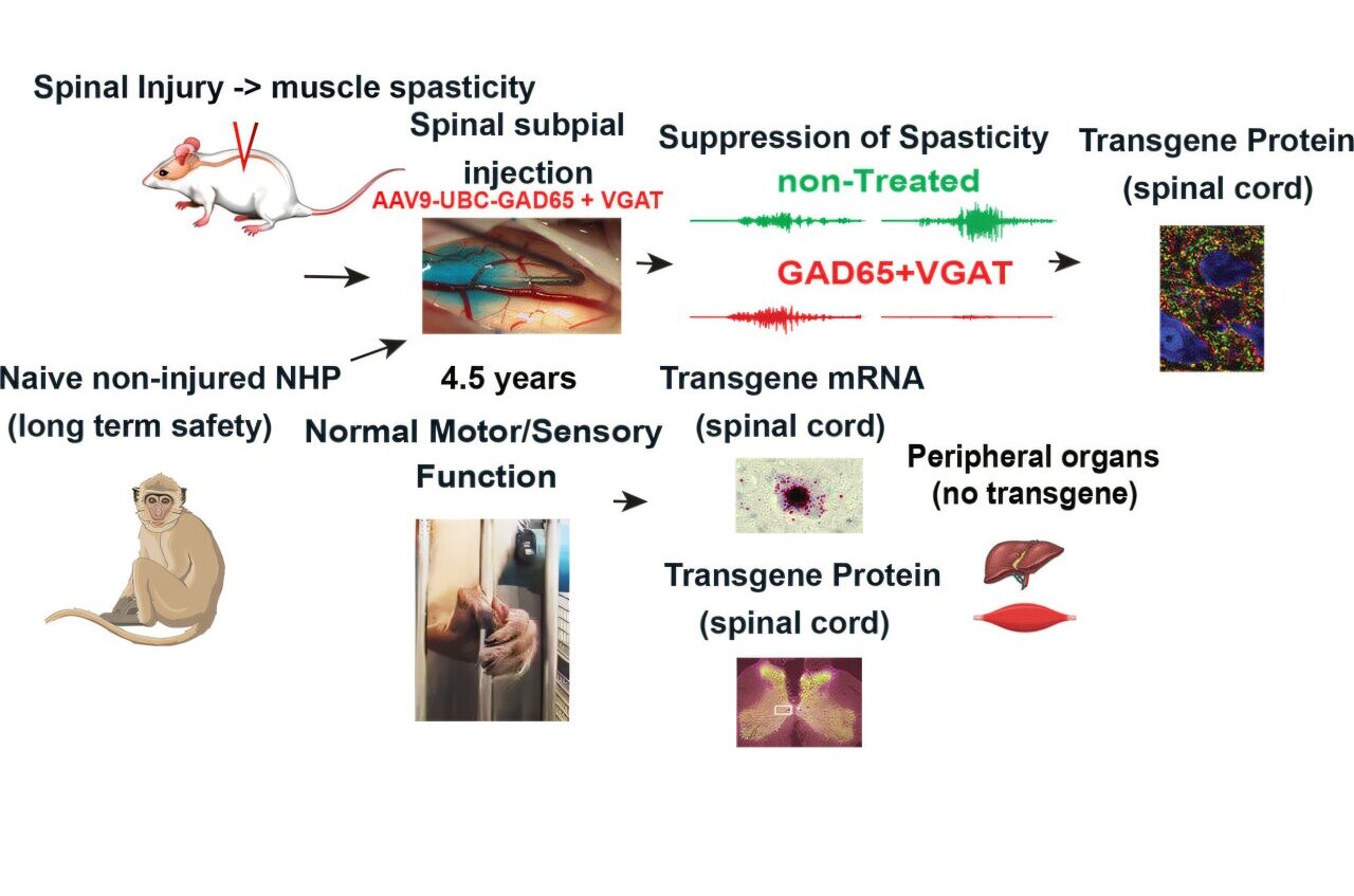 Gene therapy approach reduces muscle spasticity after chronic spinal ...