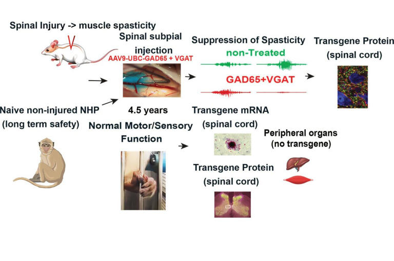 Gene therapy approach reduces muscle spasticity after chronic spinal ...