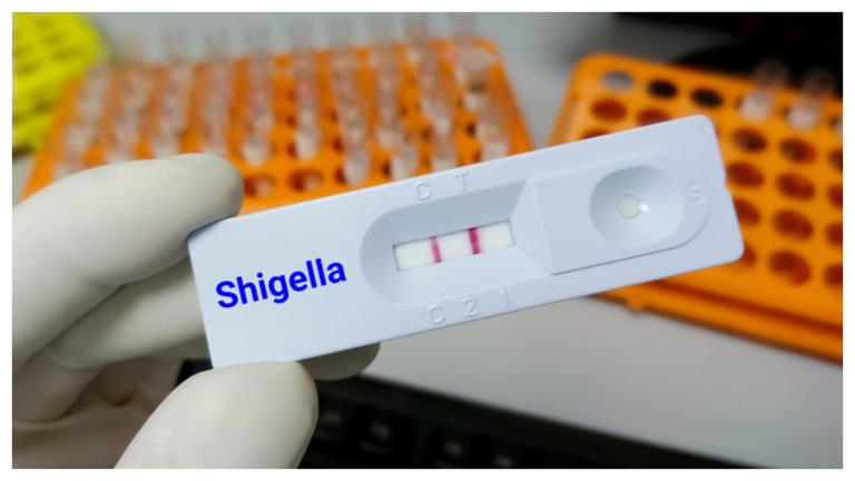 Shigella symptoms: These early signs could signal a serious gut infection!