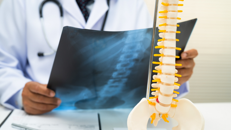 35-year-old walks same day after rare triple motion-preserving spine ...