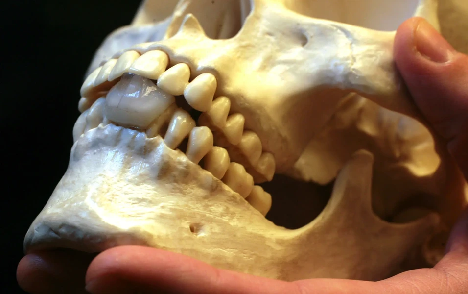Why your jaw hurts every morning