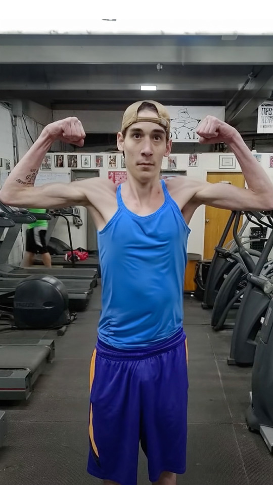 Living with cystic fibrosis