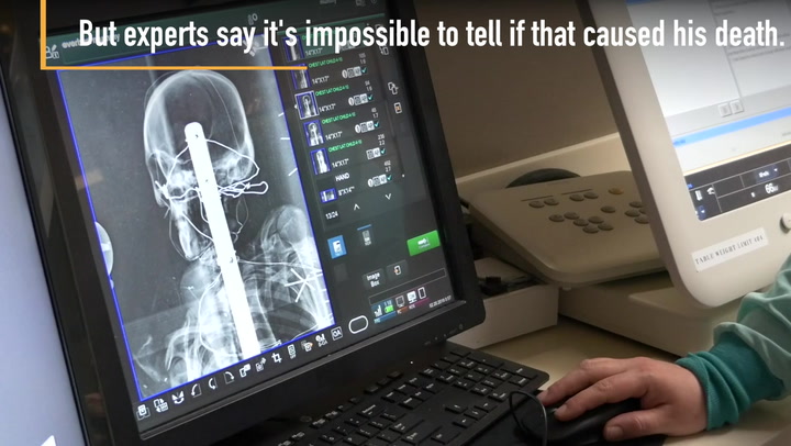 X-rays reveal mummy was a teenager