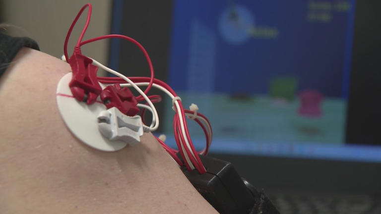 Video games show promise in stroke recovery