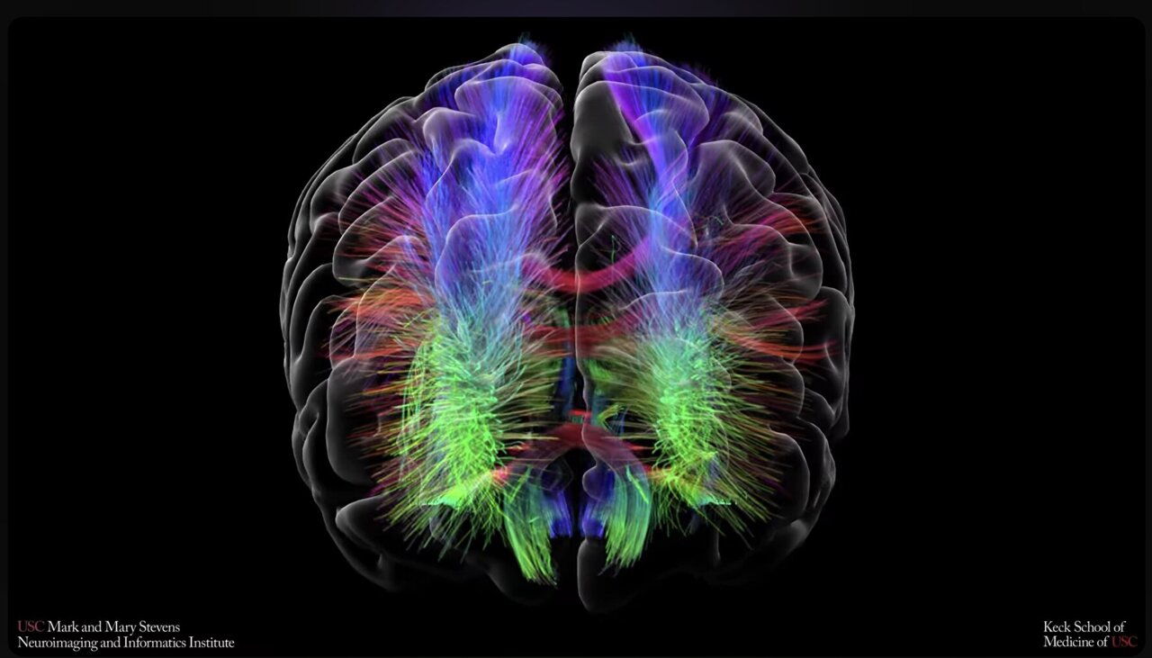 Mapping brain network changes linked to bipolar disorder severity and ...