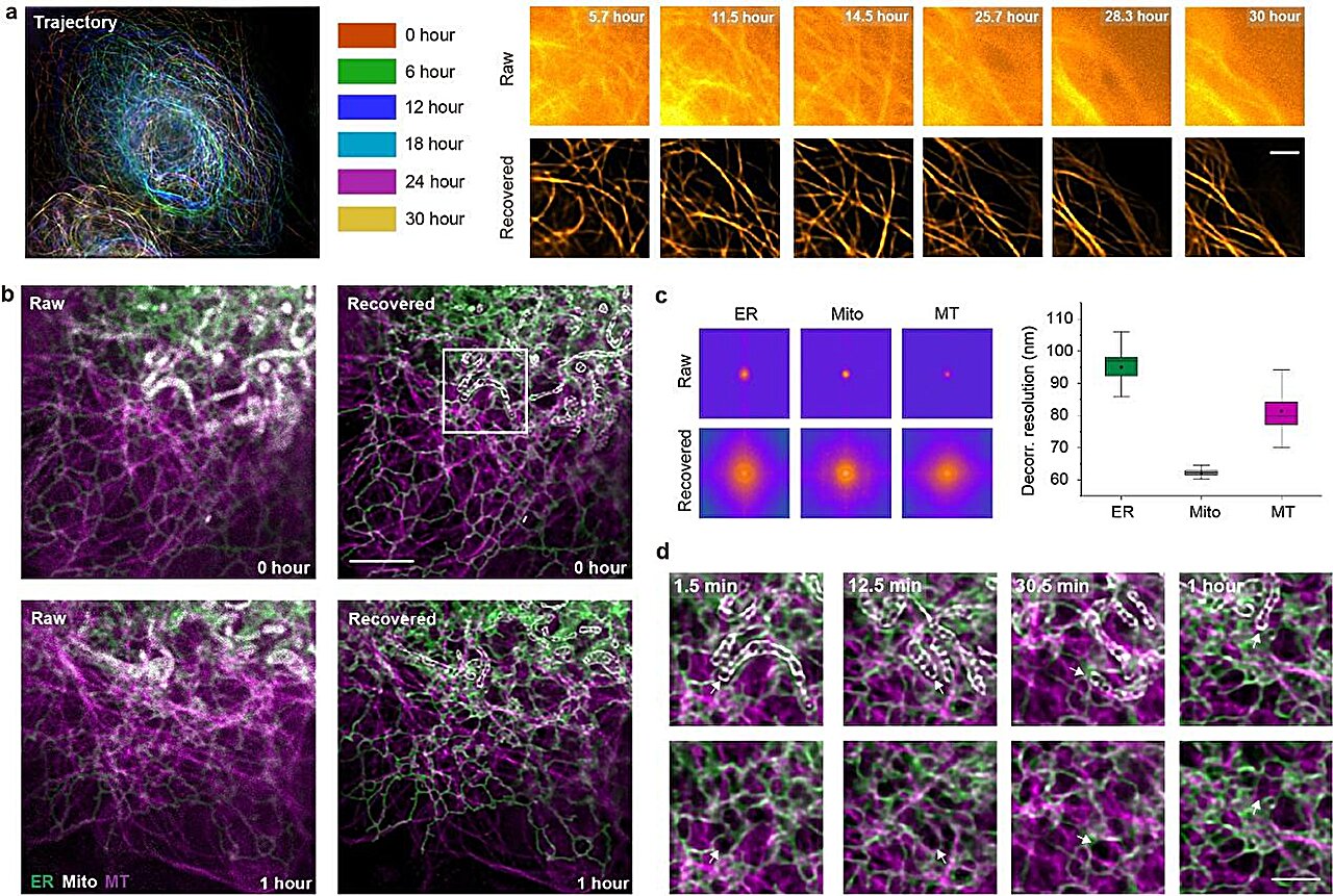 Breaking tunnel vision, imaging AI lifts fluorescence image restoration ...