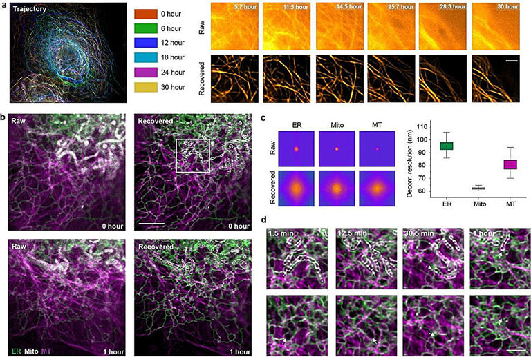 Breaking tunnel vision, imaging AI lifts fluorescence image restoration ...