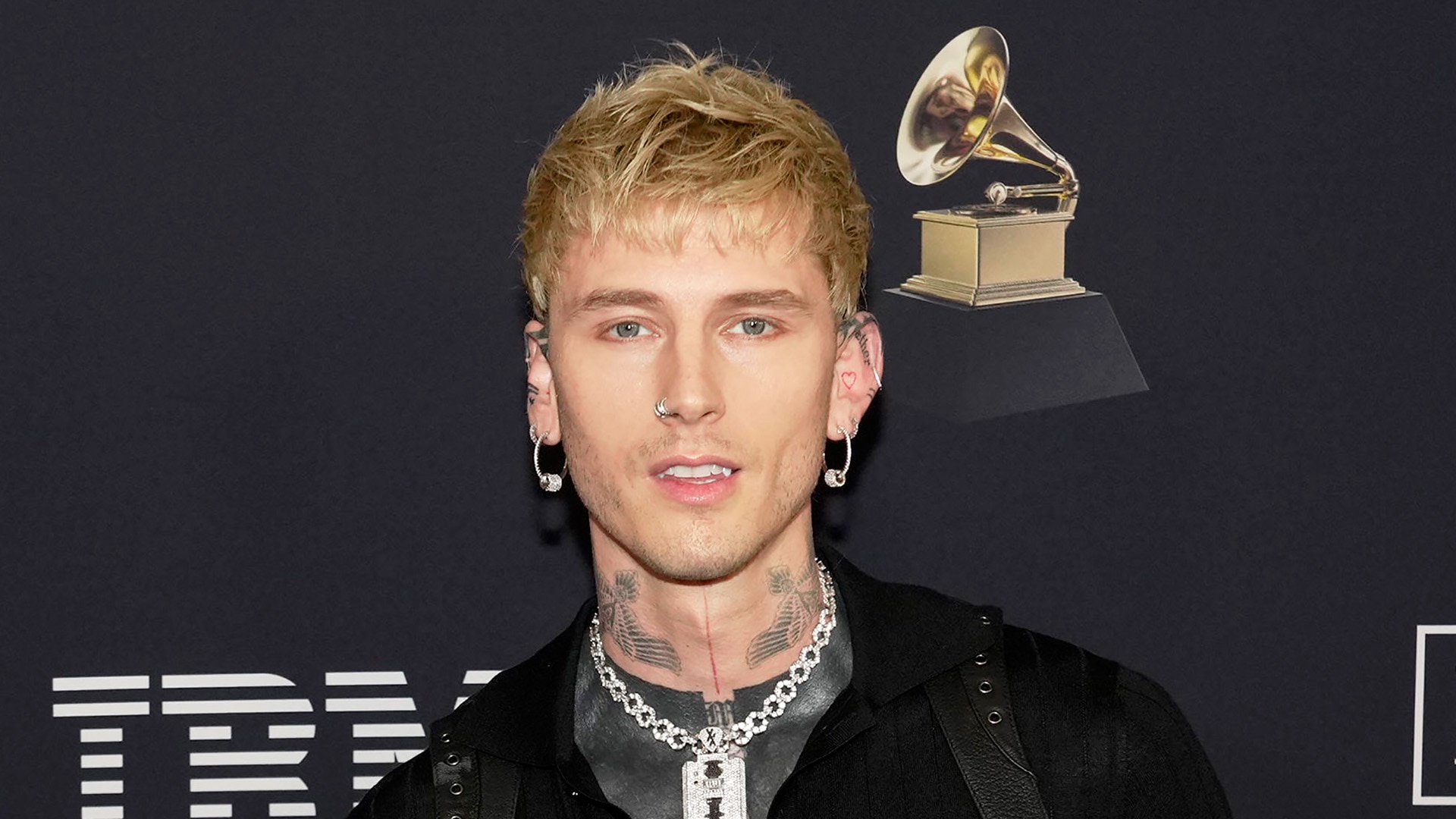 MGK reveals blackout tattoo gave him illness that turned his skin yellow