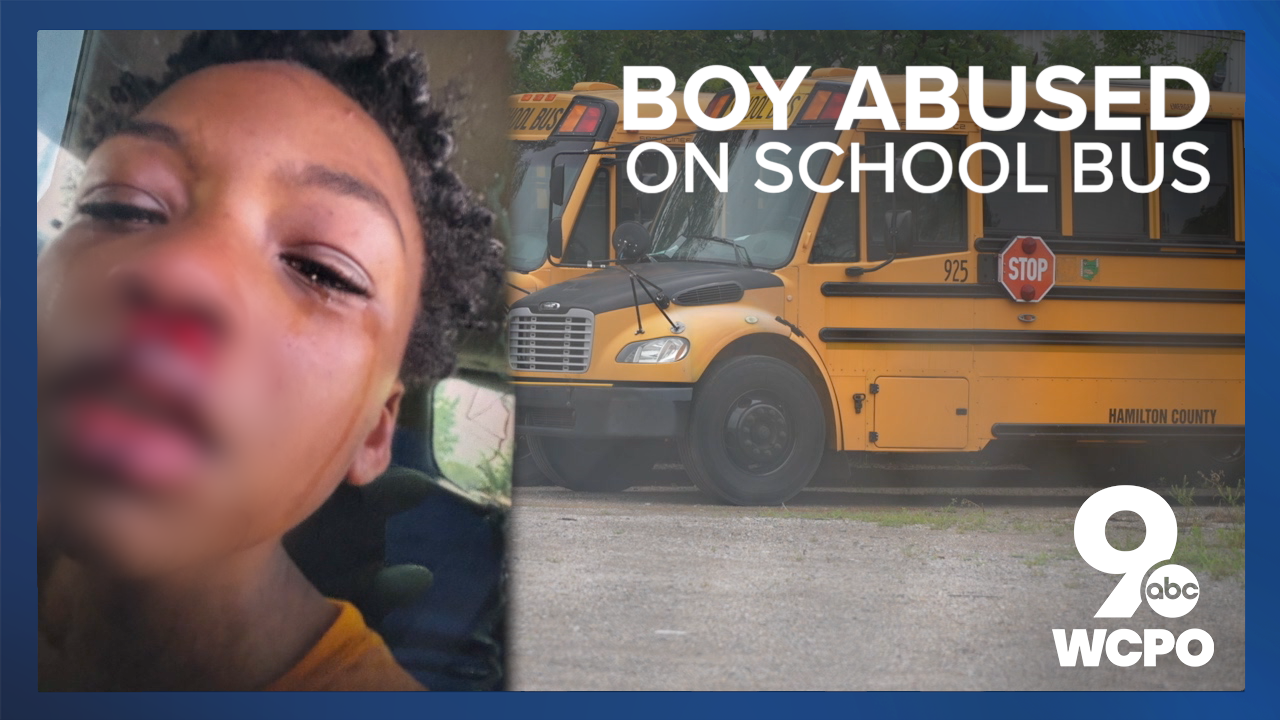 Mom says bus company, driver failed to protect son from assault