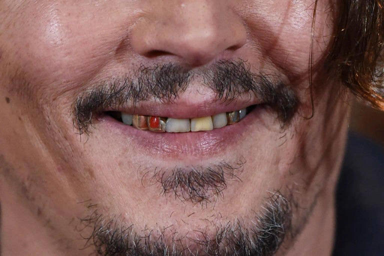 What happened to Johnny Depp's teeth? Reasons for drastic change revealed