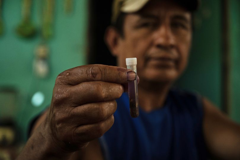 Flesh-eating bugs that burrow into victims' skin spread into second US ...