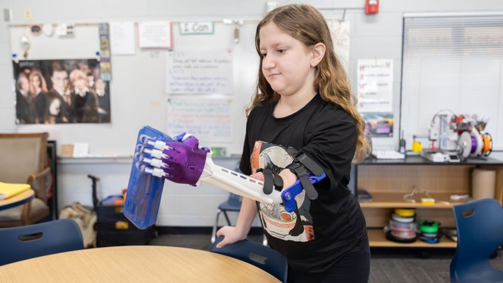Buncombe County teacher turns STEM lessons into life-changing prosthetics