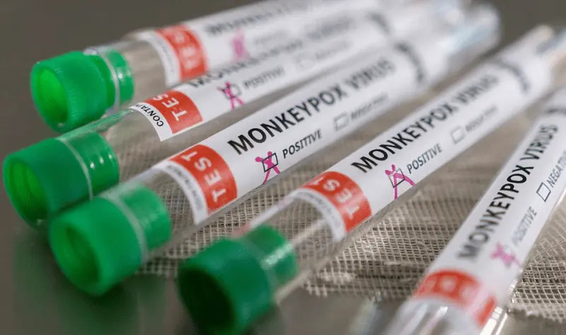 Lahore monkeypox cases rise to 54Published on: June 9, 2026 11:51 PM