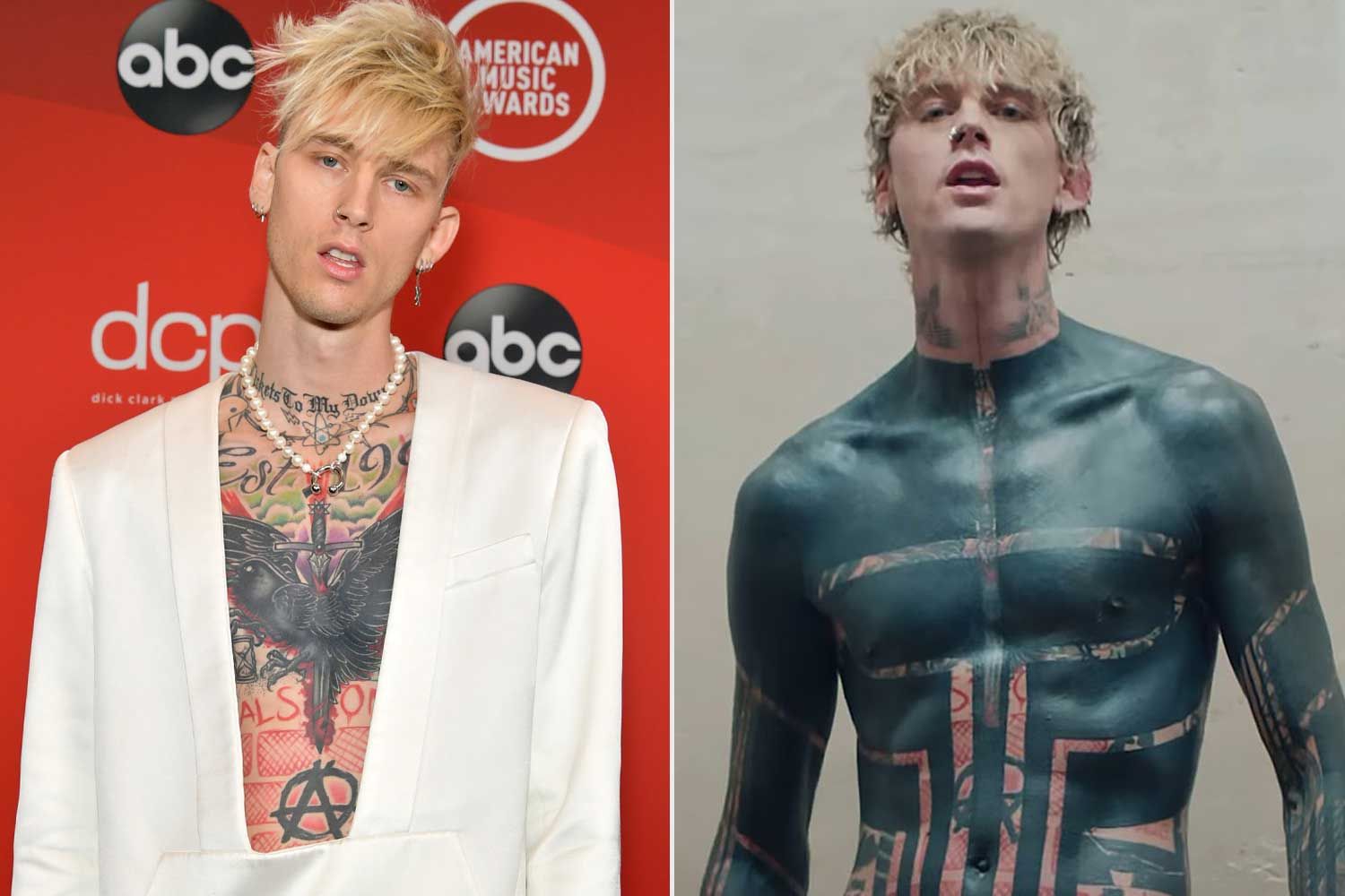 MGK details sickness that turned his skin 'yellow' as he underwent ...