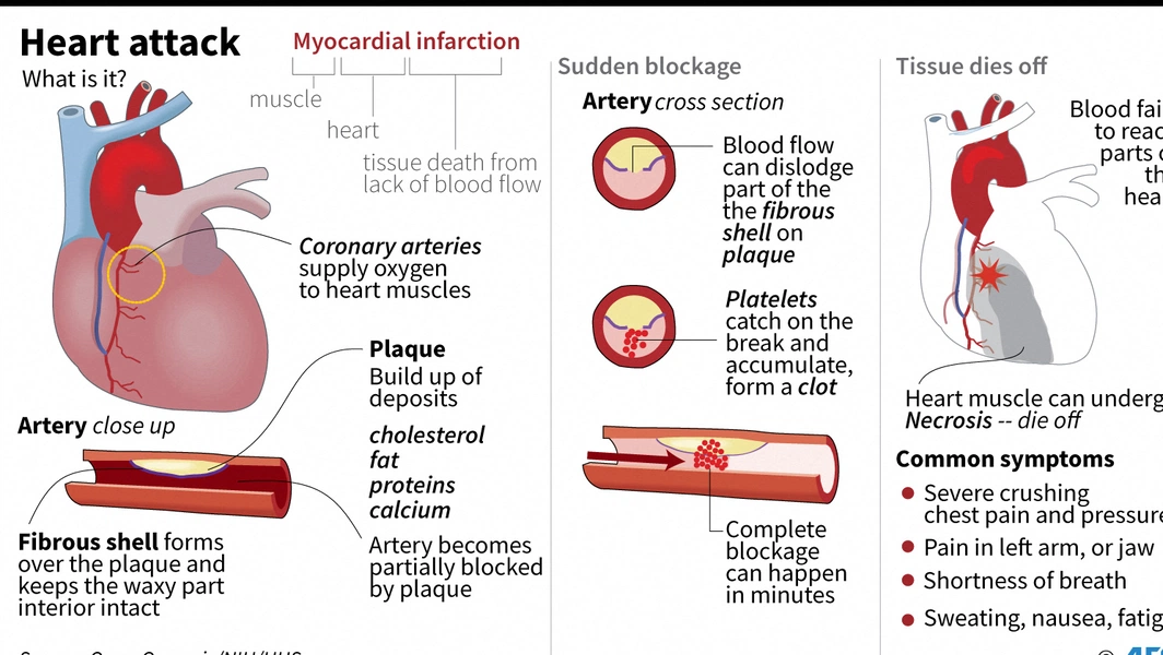 Doctors urge Lp(a) and ApoB tests to detect hidden heart risks