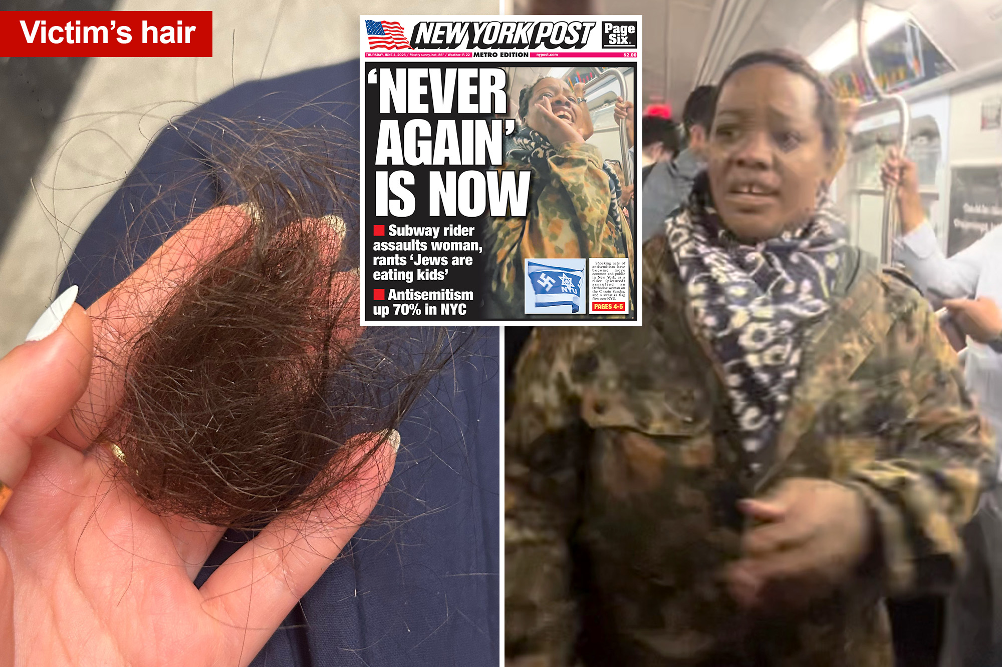 Alleged antisemitic, hair-ripping nut job lands $10K bail at NYC psych ...