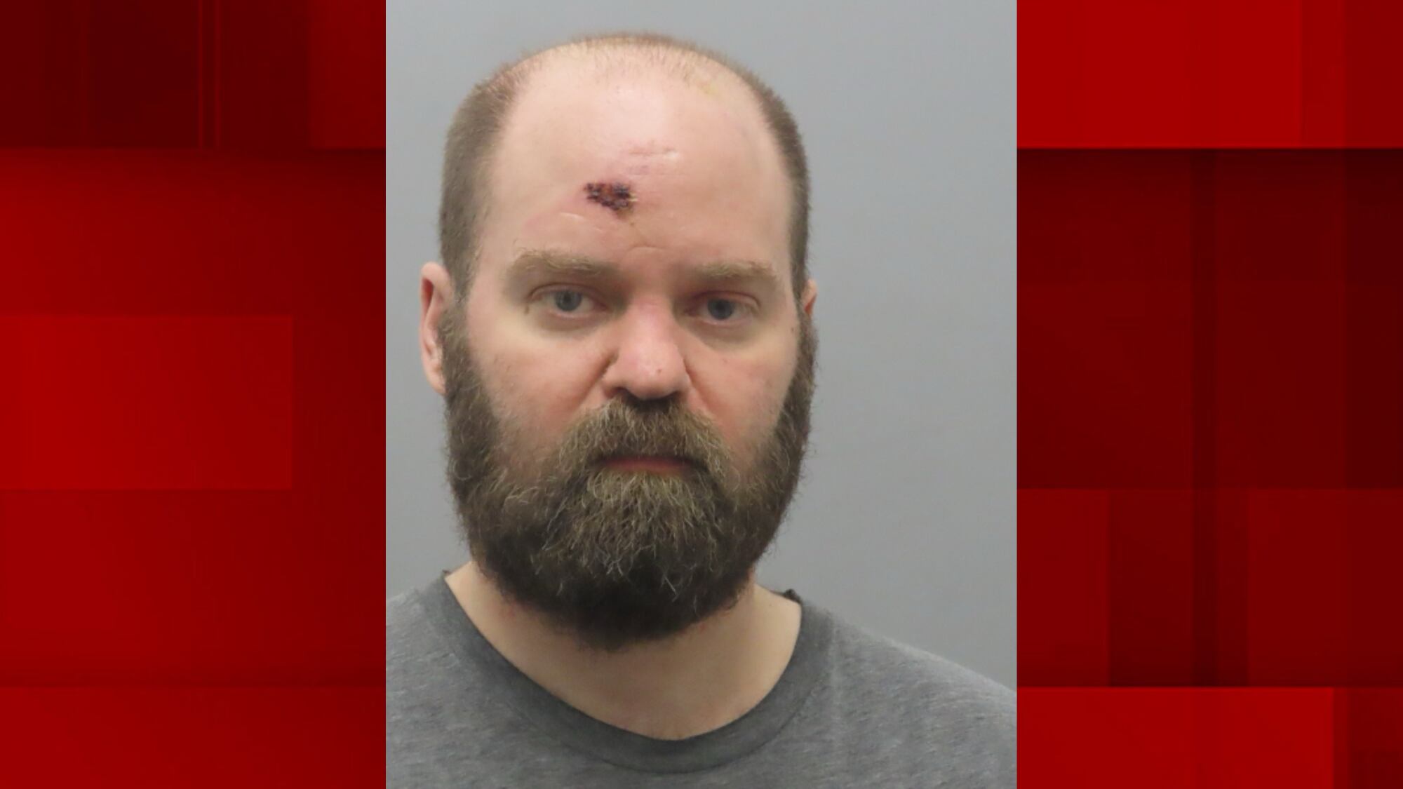 ‘Is she dead yet?’: Man accused of attacking woman inside her home