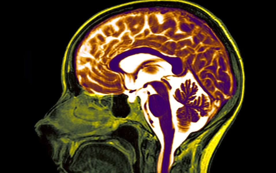 Study links poor sleep habits to signs of brain aging
