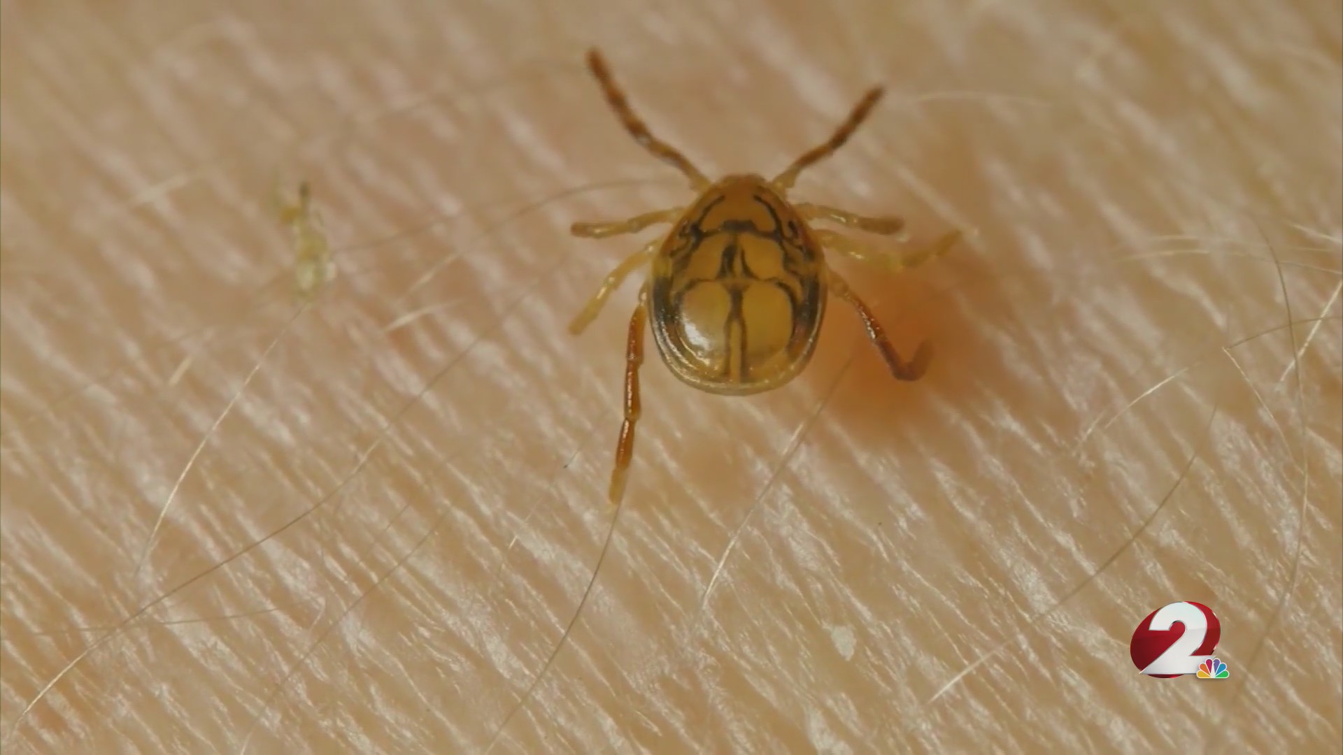 When to see a doctor after a bug bite this summer