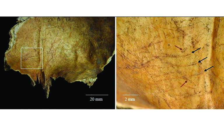 2,000 years ago in Scotland, people removed a corpse's brain and ...