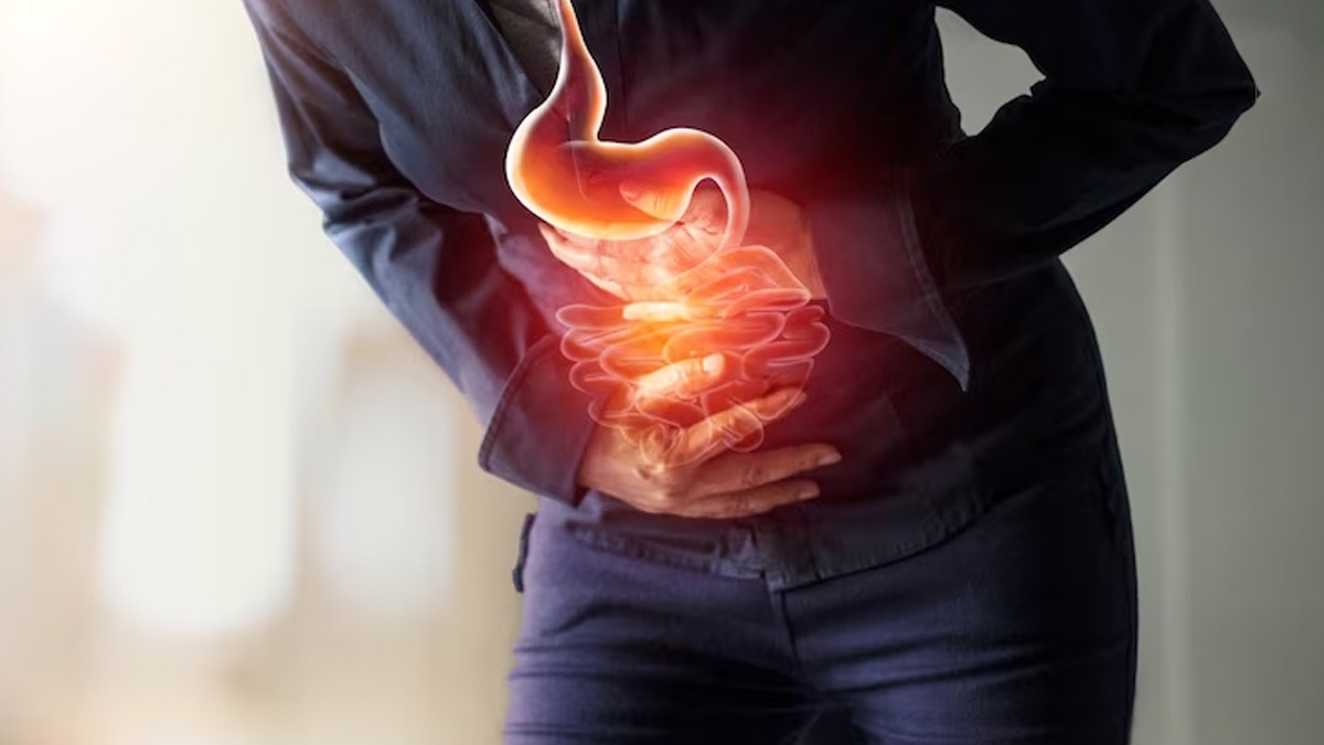 Does smoking cause acidity? A gastroenterologist explains the connection