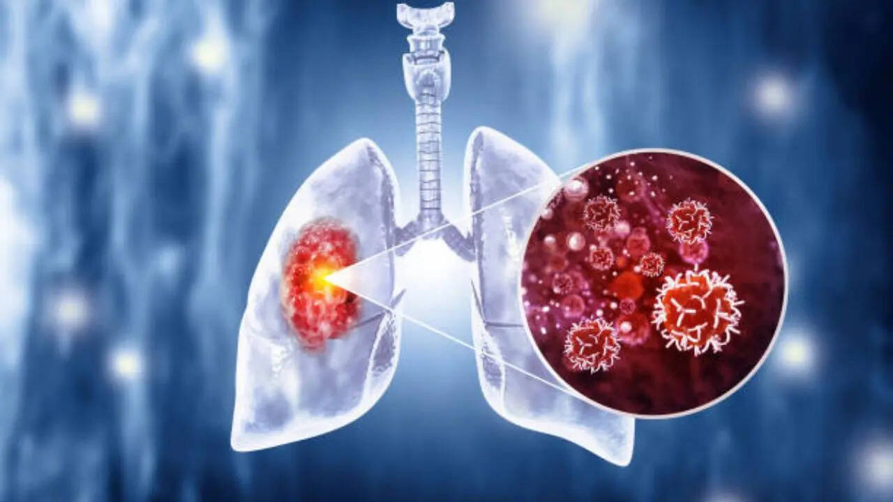 New blood test shows promise in predicting lung cancer before it starts