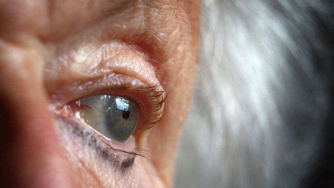 Dry eye care tips that actually work for you