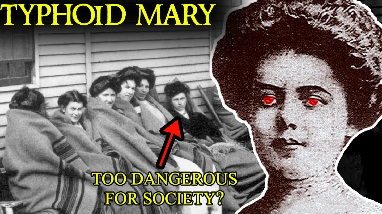 The tragic life of Typhoid Mary