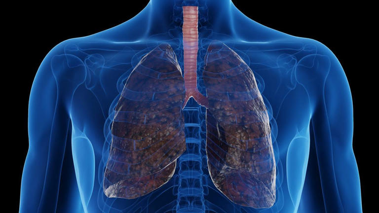 Concerning simulation shows true impact smoking has on your lungs