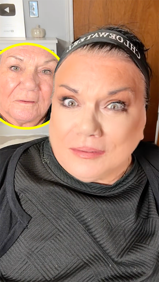 Giving an 88 year old an at home face lift 😳