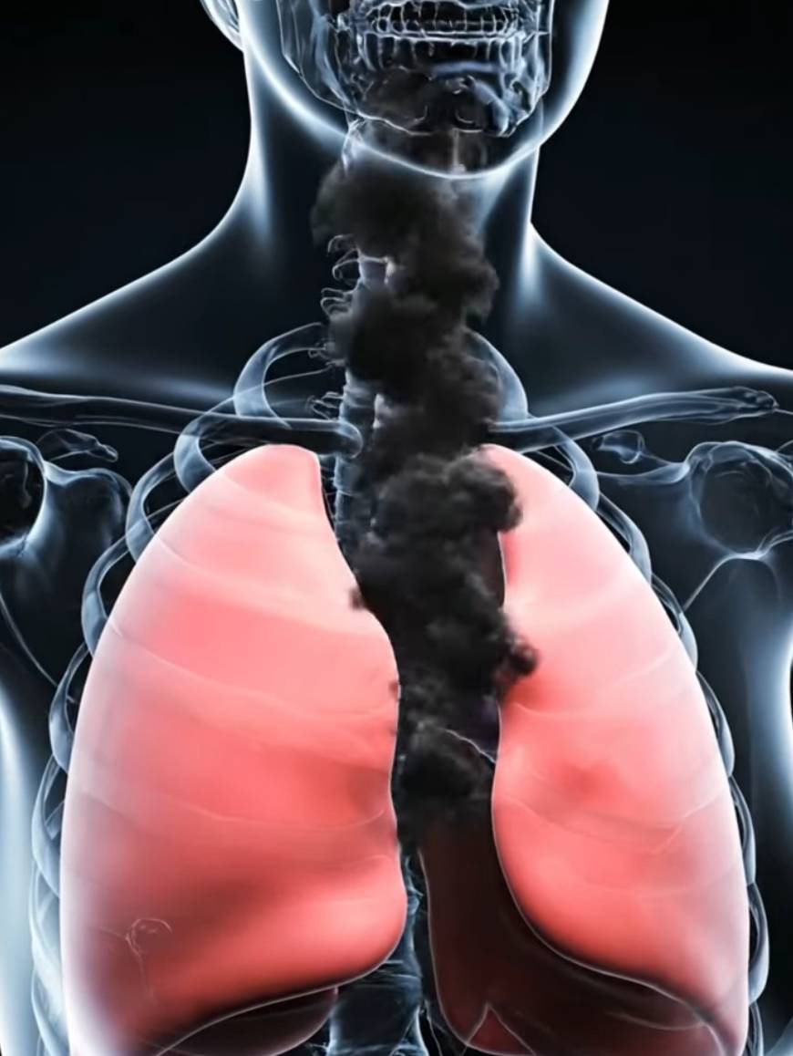 Concerning simulation shows true impact smoking has on your lungs