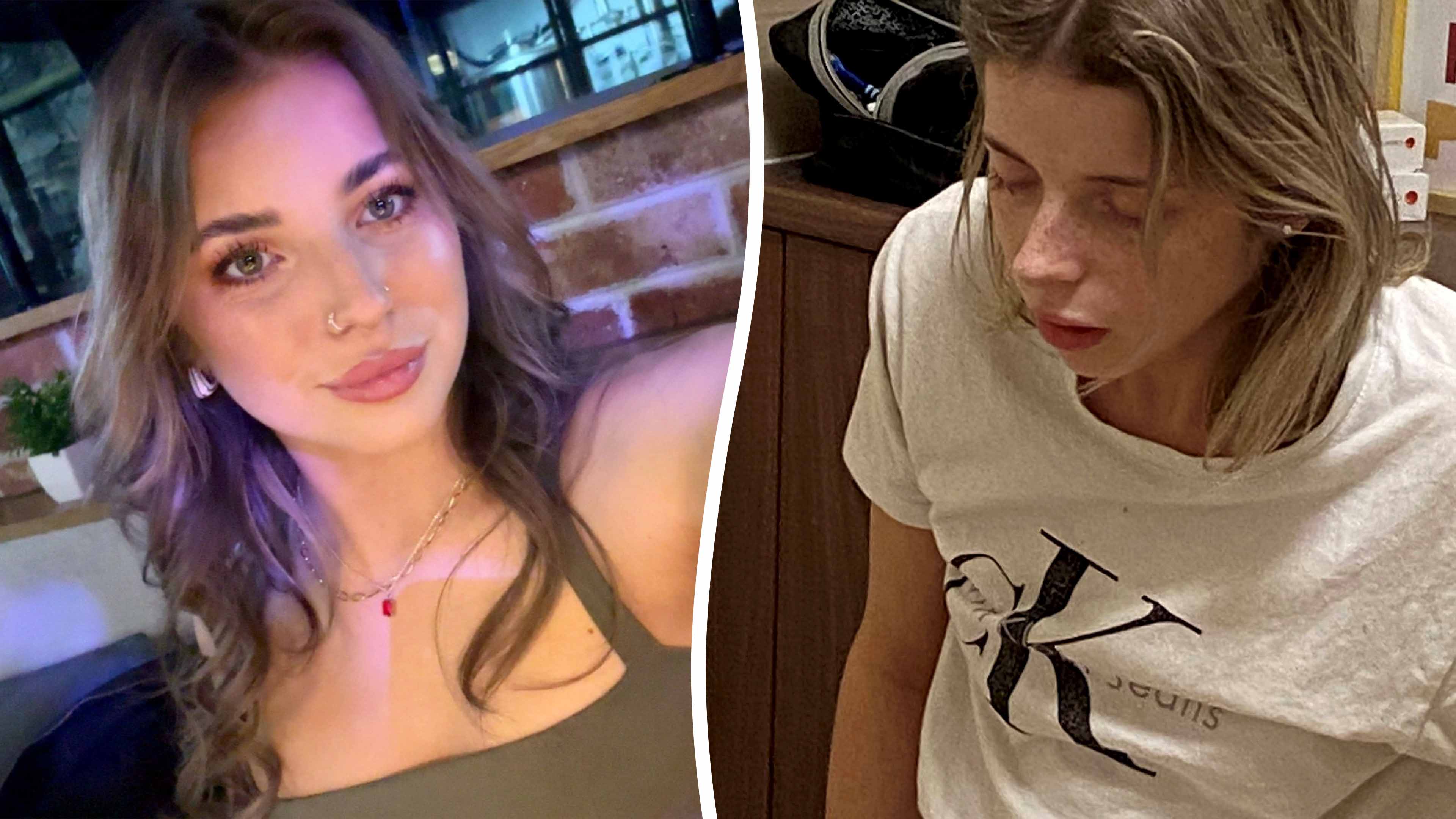 Woman, 23, left with bladder damage after $46,000 ketamine addiction
