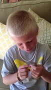 Alligator lizard bites boy's nose