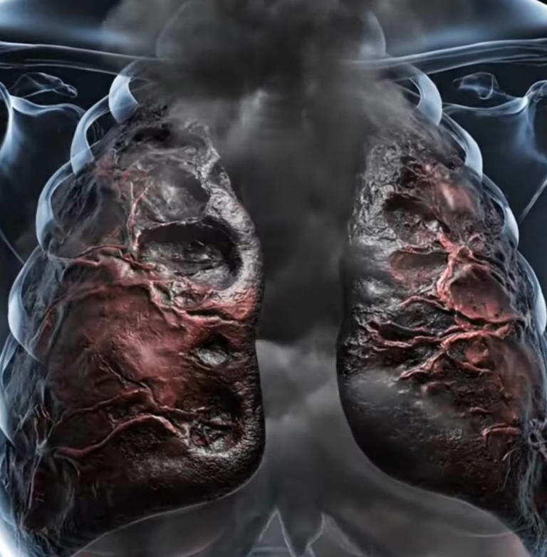 Concerning simulation shows true impact smoking has on your lungs