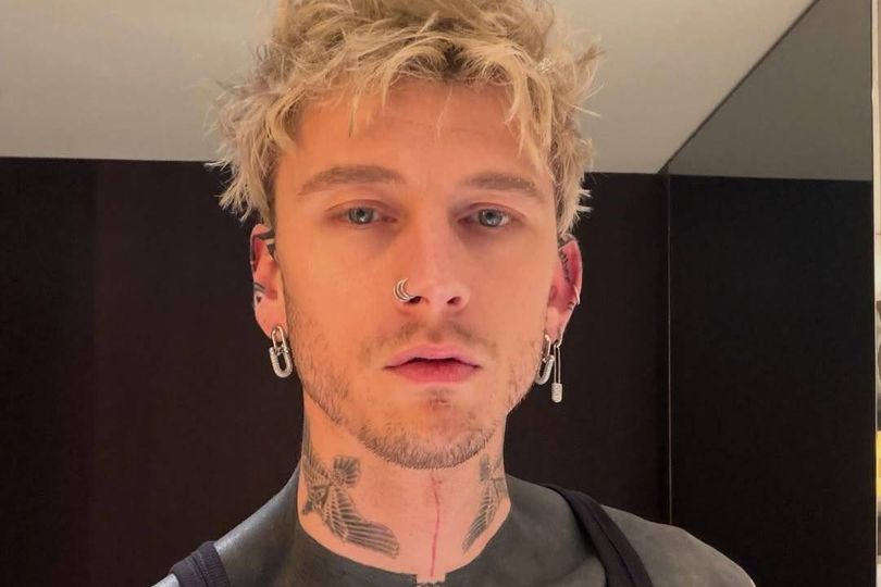 Machine Gun Kelly's skin turns yellow after injecting black tattoo ink ...